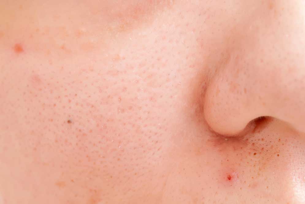 Skin Barrier Itu Apa? Cek Penjelasan Lengkapnya di Sini!