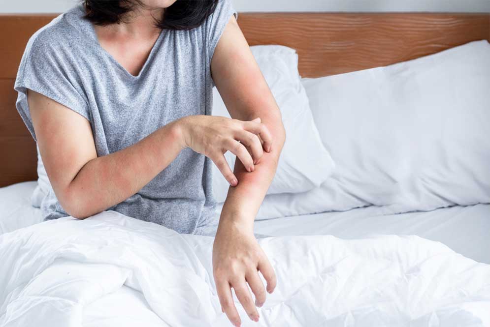 10 Penyebab Kulit Gatal dan Cara Efektif untuk Mengatasinya